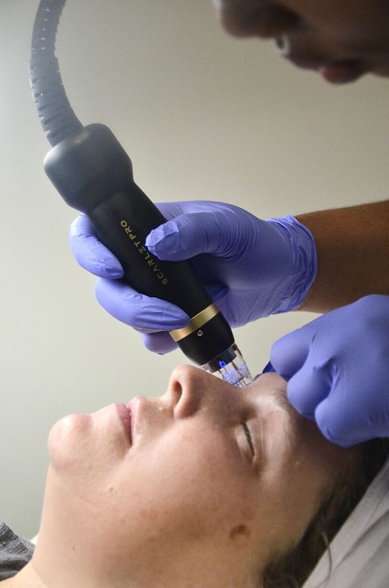 Scarlett Pro RF Microneedling - Fortier Gynecology - Raleigh, NC