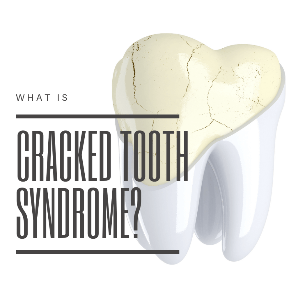 What Is Cracked Tooth Syndrome Cromwell Dentists Fedorciw
