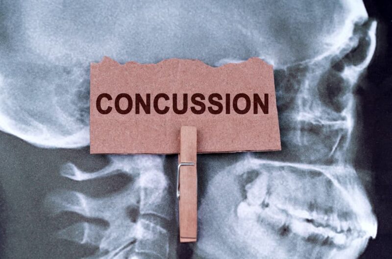 How Long to Recover from Concussion? A Step-by-Step Concussion Recovery ...