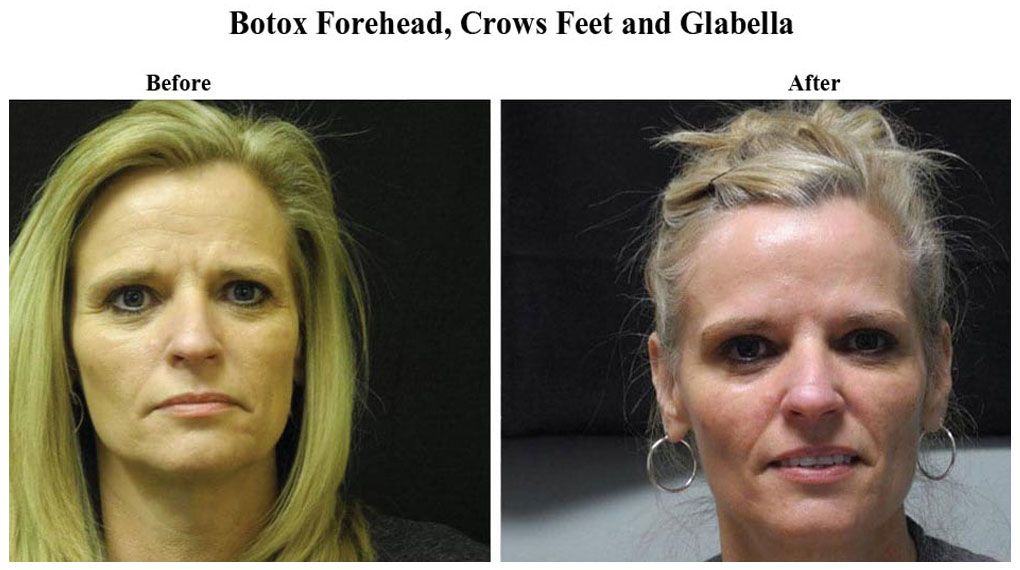 Gallery - Blue Plastic Surgery - Mooresville, NC