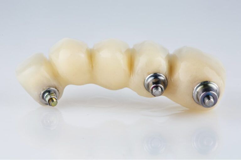 Implant | Savannah, GA and Houston, TX | Pan-Am Dental Laboratory
