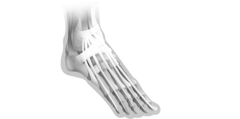McKinney Podiatrist, Foot & Ankle Doctor - Hadfield Foot and Ankle ...
