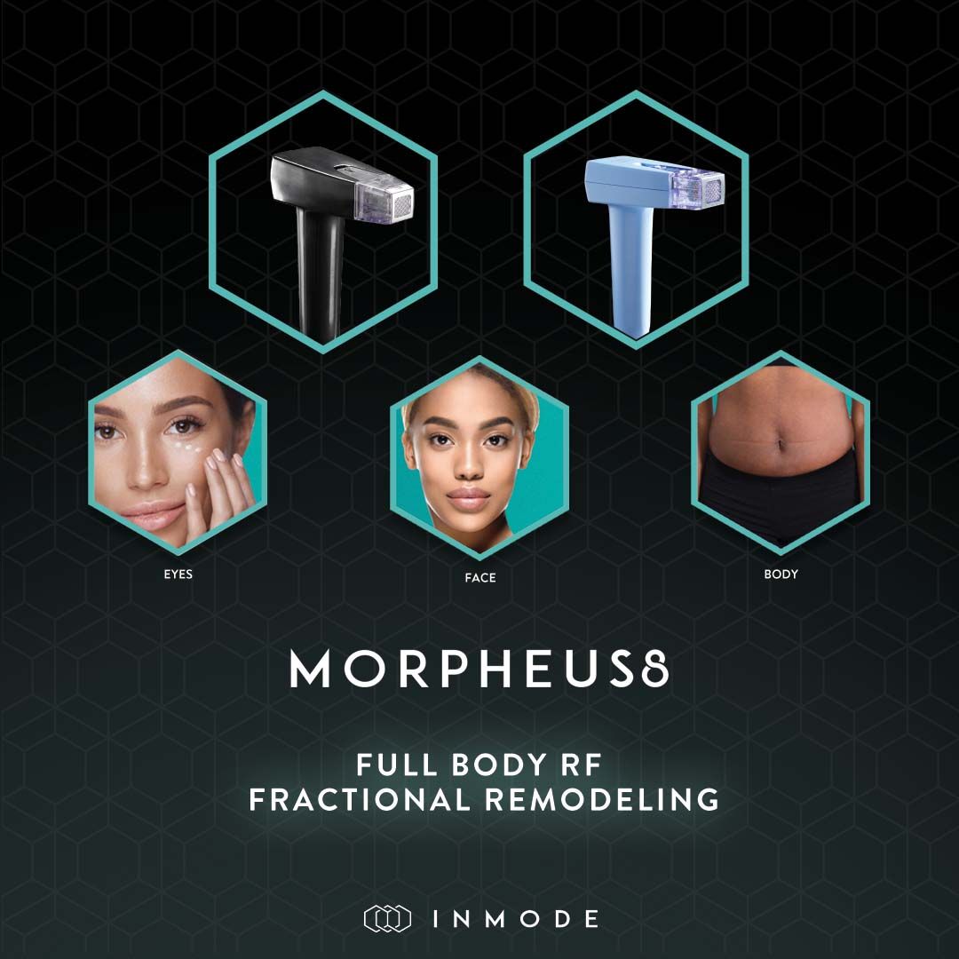 Radiofrequency Microneedling (Morpheus8) - REDJuvenation - Dallas, PA